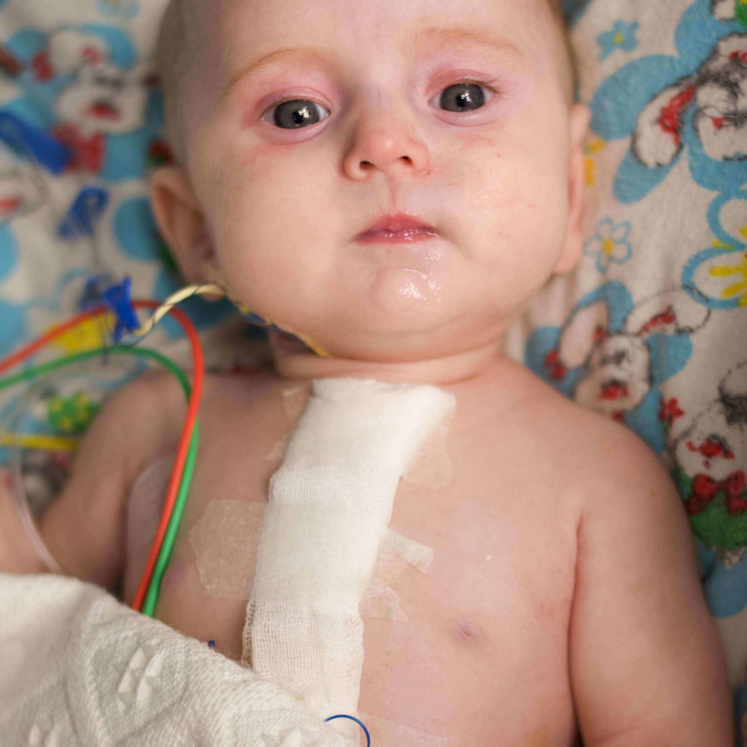 War-torn Ukraine – Irish charity provides life-saving Cardiac surgeries ...